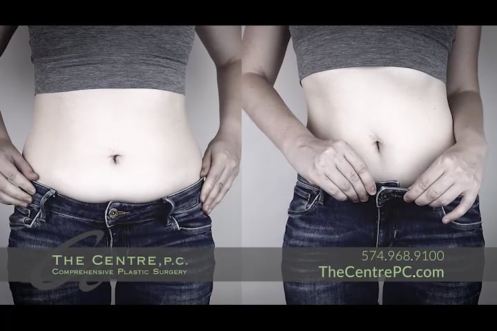 The Centre PC - Body Contour (Not for Air Version) - Bald Guy Creative